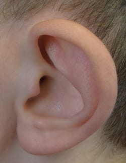 Congenital Ear Malformation Services | MUSC Health | Charleston SC