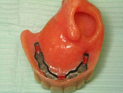 MUSC Maxillofacial Prosthodontics | MUSC Health | Charleston SC