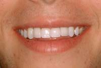 MUSC Maxillofacial Prosthodontics | MUSC Health | Charleston SC