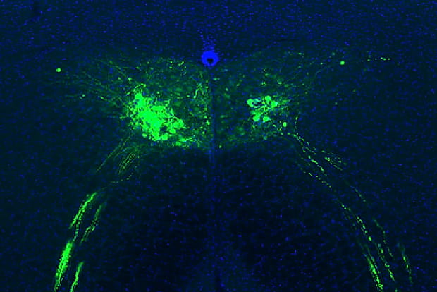 MIND Clinical Research | MUSC Health | Charleston SC